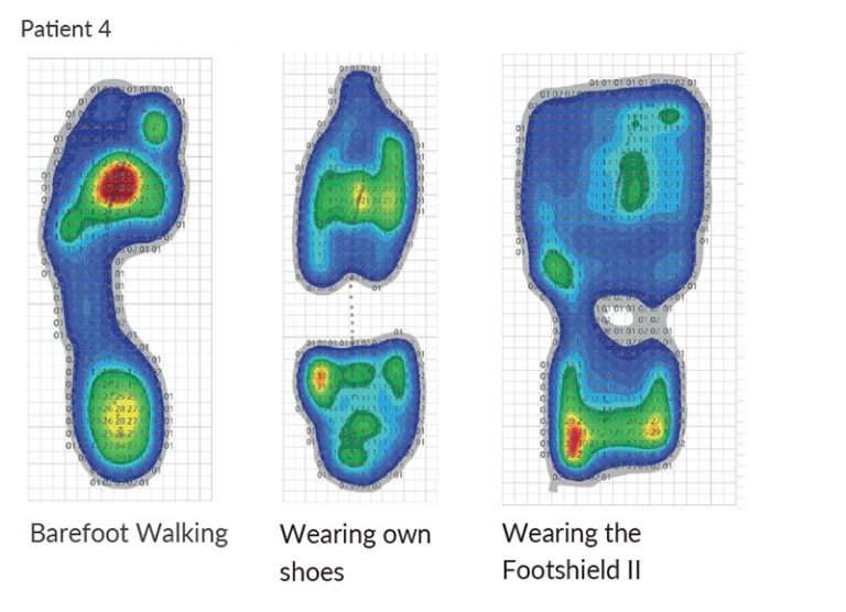 FootShield II Shoe - TalarMade Ltd